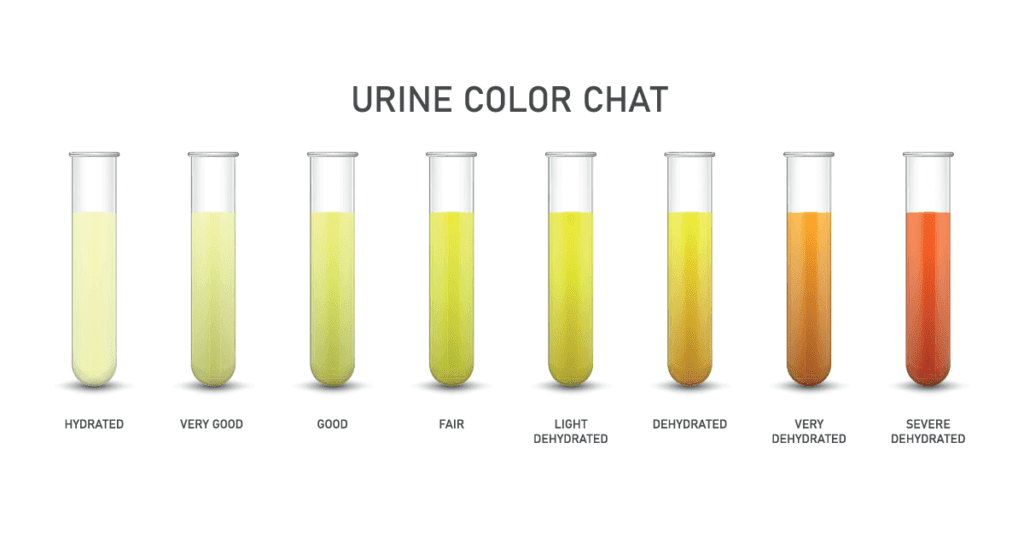 Urine Color Chart - Quick Med Care